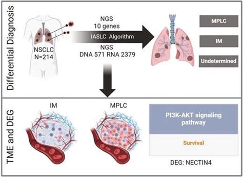 Genomic And Transcriptomic Significance Of Multiple Primary Lung Cancers Detected By Next