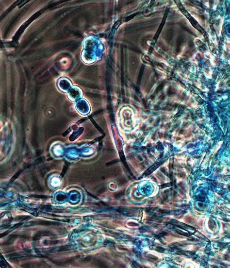 125 Questions With Answers In Isolation Of Fungi Science Topic