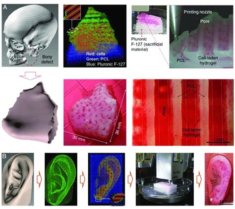 Craniofacial Bone And Cartilage Reconstruction Using Pcl As A Material Download Scientific