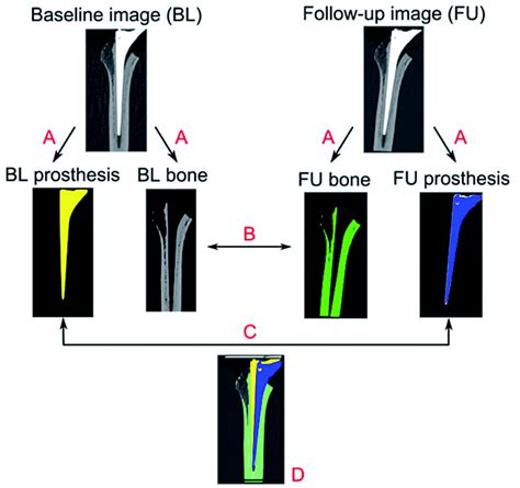 Schematic Representation Of The Proposed Method A Segmentation Of The