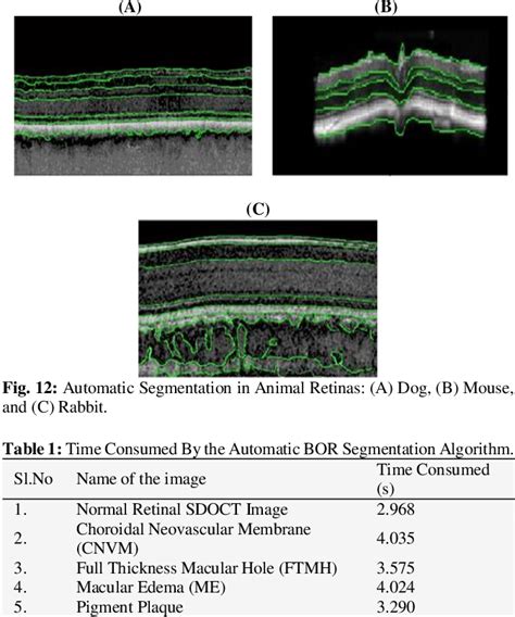 Table 1 From An Approach To Automated Retinal Layer Segmentation In Sdoct Images Semantic Scholar