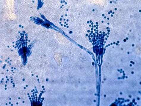 Penicillium Under Microscope