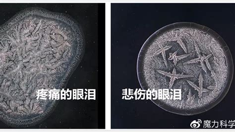 不同的情绪，眼泪的形状和成分也不同？看看科学家怎么说哭泣情感型显微镜形状科学家新浪新闻
