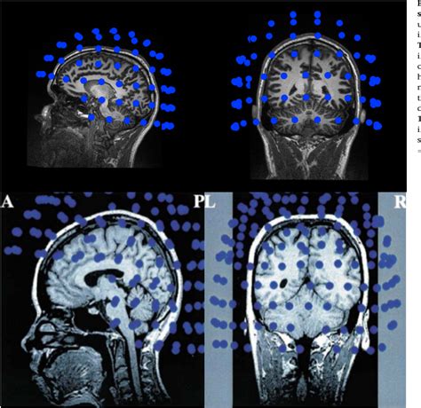 Figure 1 From Can Eeg And Meg Detect Signals From The Human Cerebellum