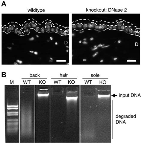 Dnase Test Definition Principle Procedure Result Uses 48 Off