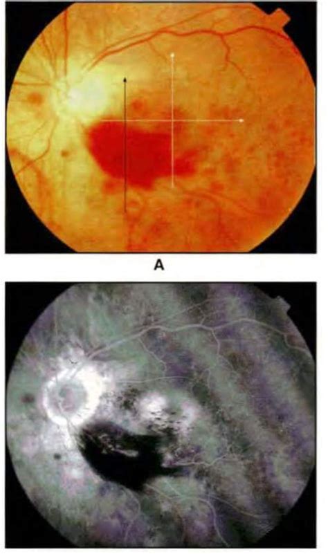 Oct Interpretation Capsules Meduweb