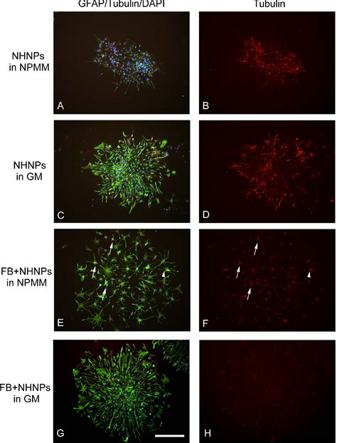 Figure 1 From Fibroblasts Isolated From Human Middle Turbinate Mucosa Cause Neural Progenitor