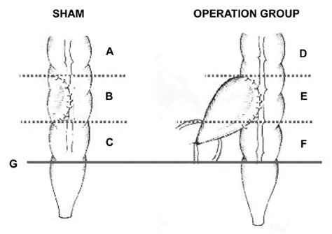 Diagram Of Division Of The Proximal Segments Of The Left Colon Above