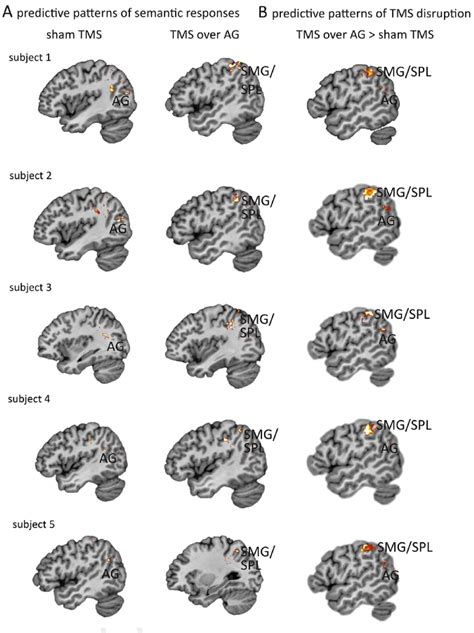 E Multi Voxel Single Subject Analysis Mvpa Results From 5