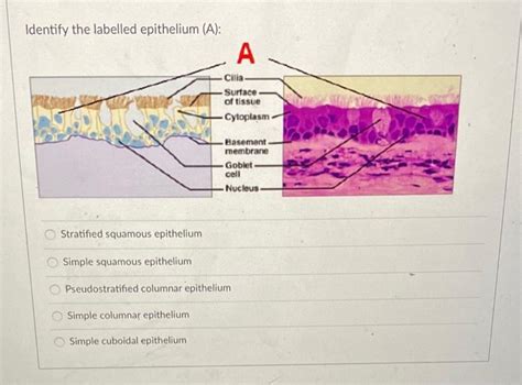Solved Identify The Labelled Epithelium A Simple Cuboidal