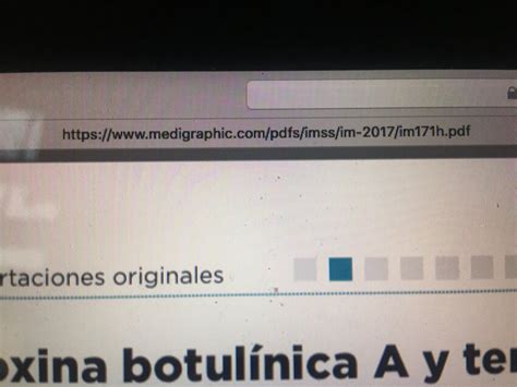 Pdf Botulinum Toxin A And Physical Therapy In Gait In Cerebral Palsy