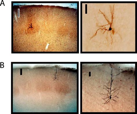 Barrel Cortex Neurons A Biocytin Filled Spiny Stellate Neuron From Download Scientific