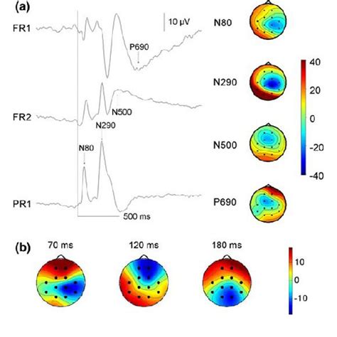 Spatio Temporal Features Of The Major Responses A Waveforms Left Download Scientific