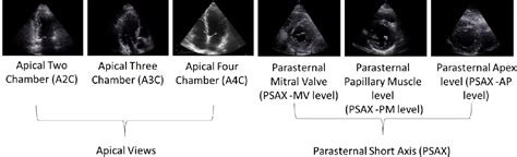 Figure 1 From Classification Of Echocardiogram View Using A Convolutional Neural Network