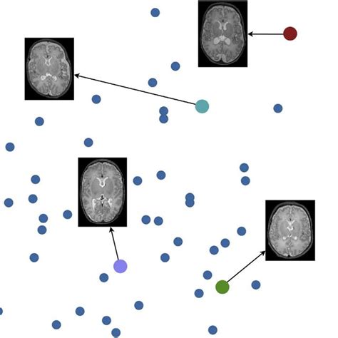Illustration Of The Atlas Selection Principle The Brain Images Download Scientific Diagram