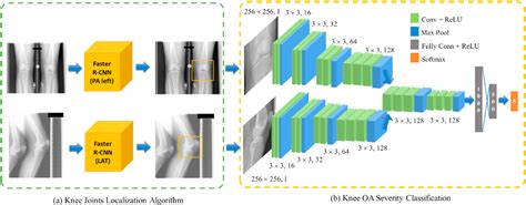 Figure 1 From Deep Learning Based Algorithm For Assessment Of Knee