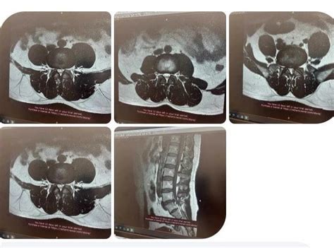 ☝️ Аарцаг Нурууны багц эмчилгээг хийлгэснээр эрхтэн системийн үйл ажиллагааг сайжруулж бие