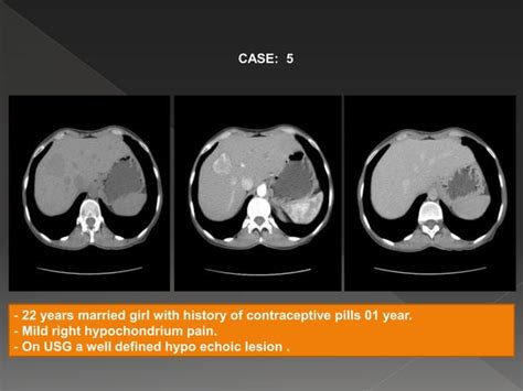 Liver Imaging Ct Scan Algorithm Pptx Lung And Respiratory Health