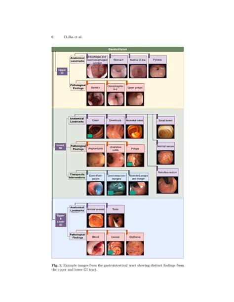 Gastrovision A Multi Class Endoscopy Image Dataset For Computer Aided