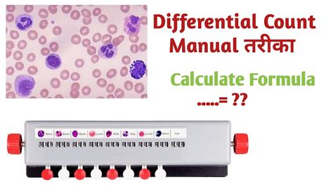 manual wbc differential count procedure at nicholas bruny blog