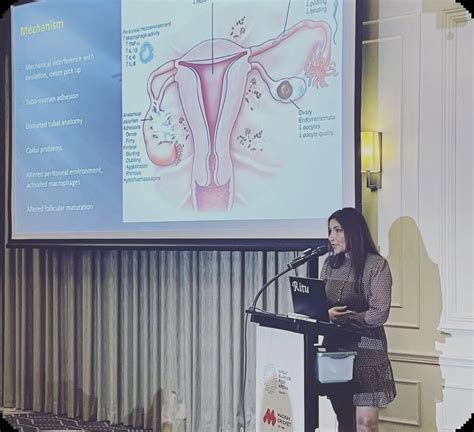 Ovulation Induction And Planning Fertility Specialist Mackay