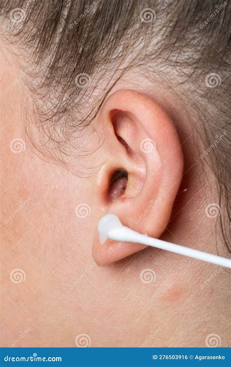 Abscess Earlobe At James Engel Blog