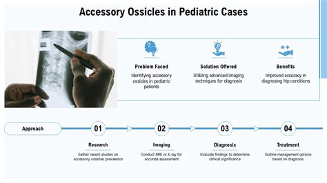 Accessory Ossicles In Pediatric Cases Ppt Slides Acp Ppt Example
