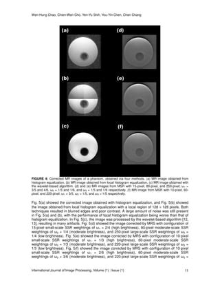 Correction Of Inhomogeneous MR Images Using Multiscale Retinex PDF