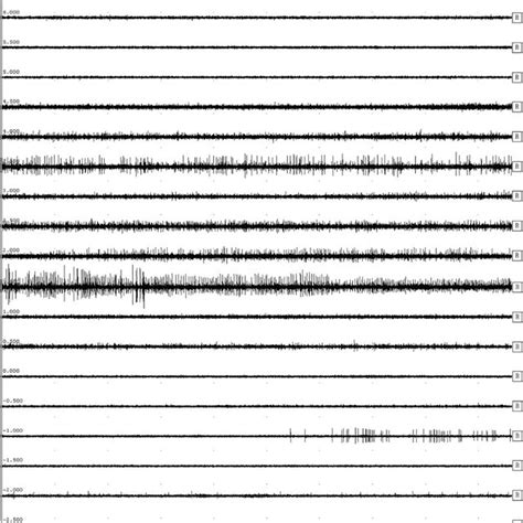 Typical Bursting Patterns From Microelectrode Recording Download