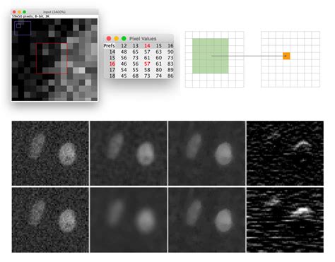 neighbourhood filters introduction image analysis training resources