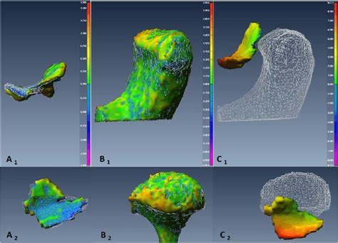 Tmj 3d Reconstructed Models Representative Of Tmj From An Mri Cbct Download Scientific Diagram