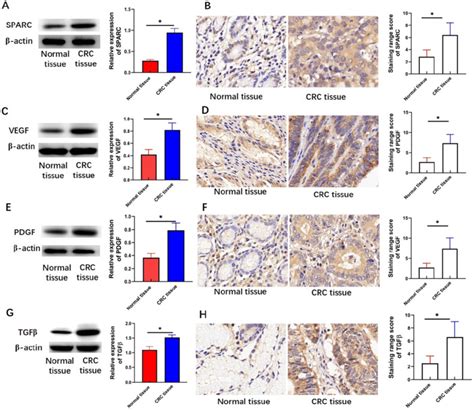 Expression Levels Of Sparc Vegf Pdgf And Tgf β In Crc Tissues A Download Scientific