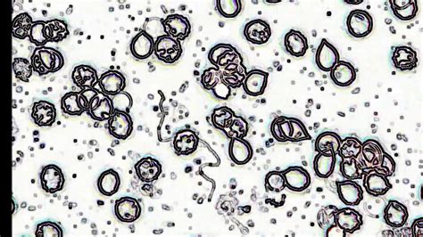 Lymes Disease Under Microscope At Mitch Moore Blog