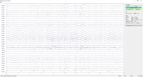 Eeg Fnirs Cookbook Brain Products Gmbh