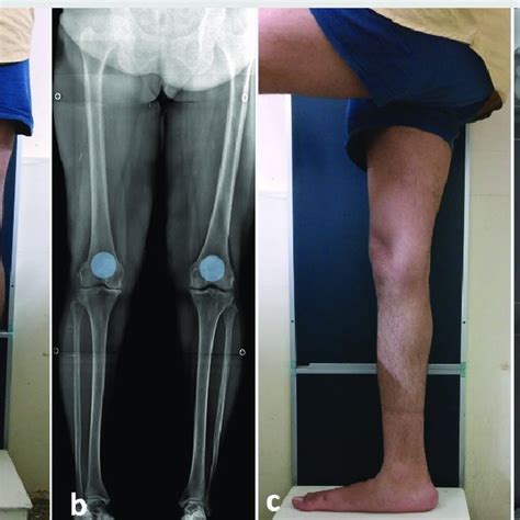 A The Correct Method Of Positioning A Patient For An Anteroposterior Download Scientific