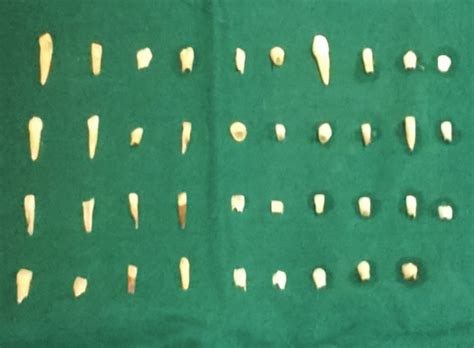 Samples For Estimation Of Calcium Dissolution Potential Download
