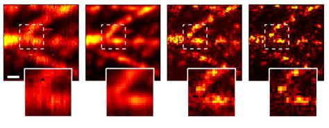 Far Field Sub Diffraction Limited Imaging Techniques Dan Oron