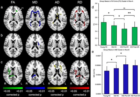 Tract Based Spatial Statistics Images Colored Regions Showing A Download Scientific