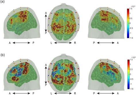 Figure 4 From Development And Validation Of Immersive Hand Rehabilitation System Using A Vr