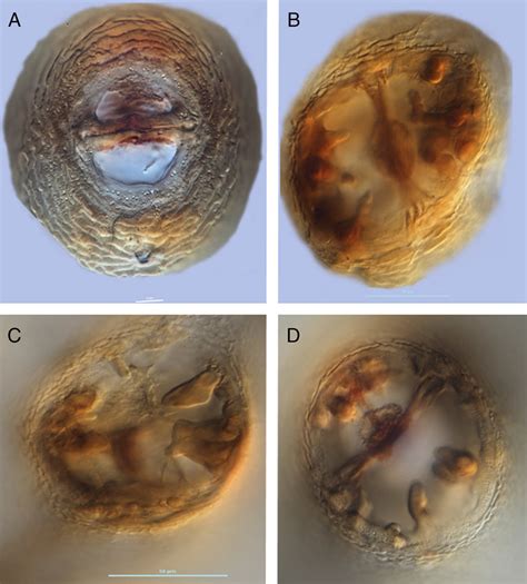 A D Light Micrograph Of Vulval Cones Of H Medicaginis Showing