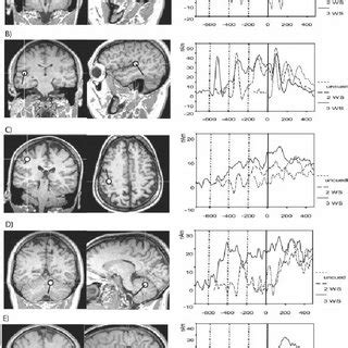 Responses Determined From The MEG Data For Activity In A Left Auditory Download Scientific