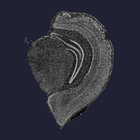 Transcriptomics Solution Stomics