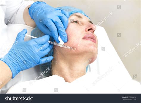 Adult Woman Undergoes Cosmetic Injection Process Stock Photo 730895698 Shutterstock