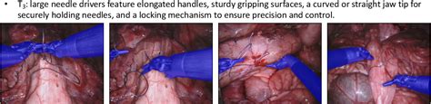 Figure 1 From Text Promptable Surgical Instrument Segmentation With Vision Language Models