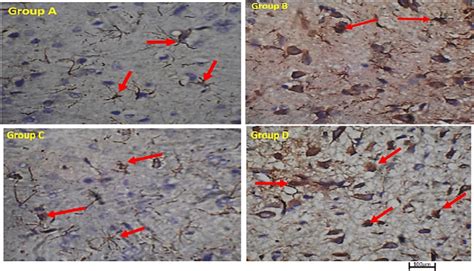 representative photomicrograph of the prefrontal cortex pyramidal cell