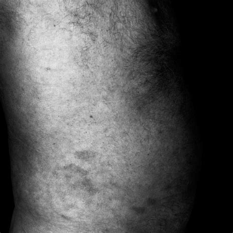 Changes In Intrinsic And Photodamaged Skin Download Table