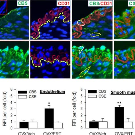 Cbs And Cse Mrna And Protein Expression In Carotid Artery Ca From Ovx