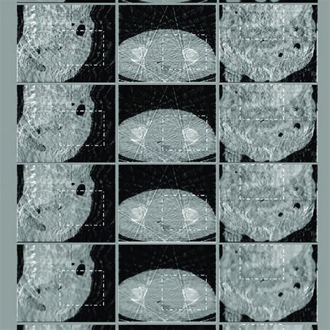 Procedure Of Compressed Sensing Based Reconstruction Algorithm Using