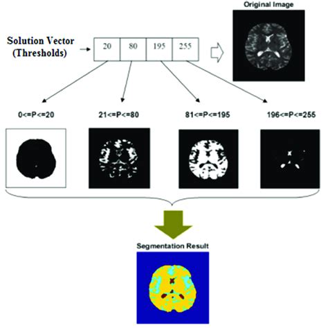 The Structure Of A Solution Vector In Sso Algorithm For Mri Segmentation Download Scientific