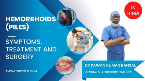 Hemorrhoids Piles Rectal Bleeding Causes Symptoms Treatment